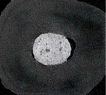 Explorando a Eficiência do MTA e MTA Flow em Condições Clínicas ...